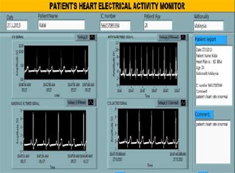 Gui Design Of Ecg Acquisition Using Labview Software Download Scientific Diagram