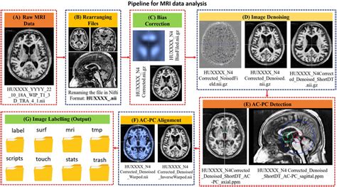 A Schematic Diagram Of The Steps Involved In The Mri Data Processing