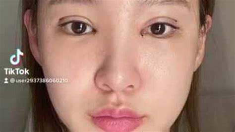 연예인쌍꺼풀수술 리얼 후기 쌍수눈매교정후기눈재수술후기눈재수술유명한곳 네이버 Tv