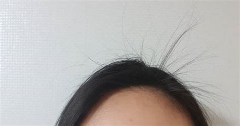 나 바보털 있어ㅋㅋㄱㅋㅋ 인스티즈 Instiz 익명잡담 카테고리