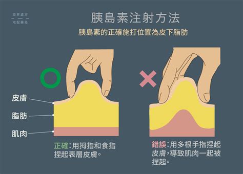 圖解胰島素注射步驟，輕鬆降血糖｜家天使 找看護第一品牌