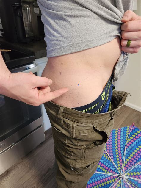 Is This A Proper Ventrogluteal Injection Site R Testosterone