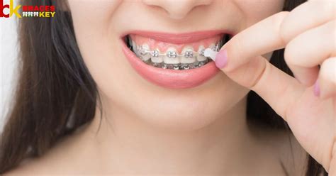 Rubber Bands Hurt At Indiana Seery Blog