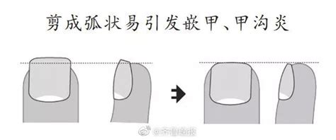 剪指甲最好剪成方形的