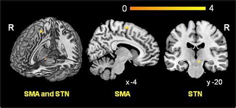 Result Of The Psycho Physiological Interaction Analysis Ppi
