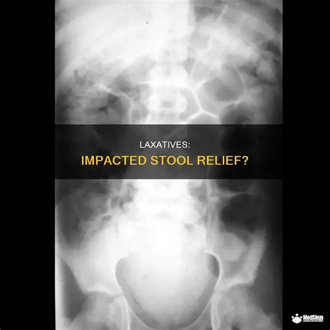 Laxatives Impacted Stool Relief Medshun