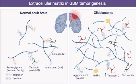 The Extracellular Matrix In Gbm Tumorigenesis The Features Of