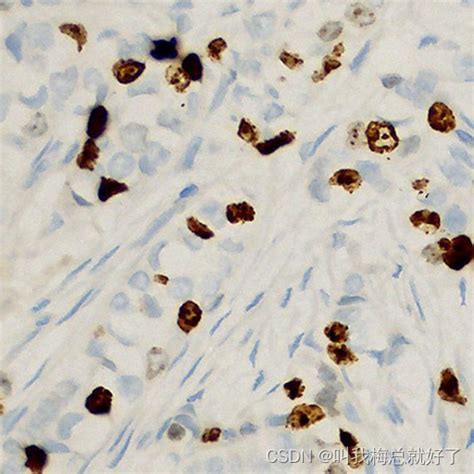 【ddrnet】ddrnet项目使用单gpu、自己的数据集训练、得到测试图像 Csdn博客