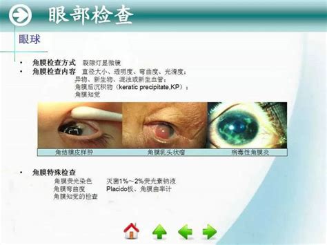 眼科基础 眼科常用检查法 PPT版 中国眼科网 yanke360