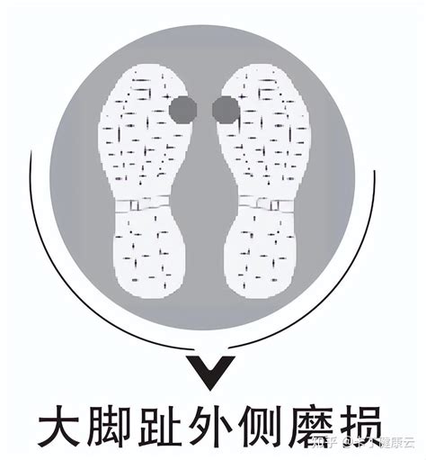 孩子特别费鞋鞋底磨损走路费鞋可能是孩子的足部出现问题了 知乎