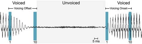 Acoustic Waveform Of The Vowel Voiceless Consonant Vowel Production Download Scientific