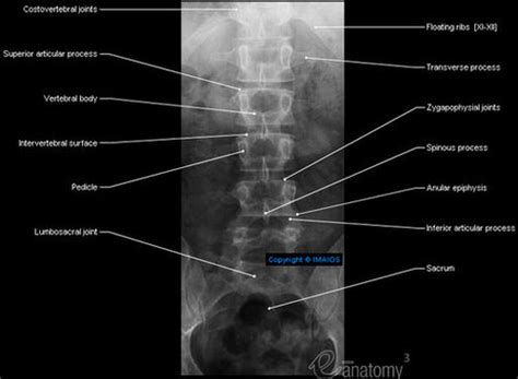 6 L Spine Projections Flashcards Quizlet