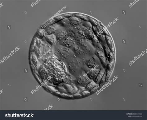 Blastocyst Images Stock Photos Vectors Shutterstock