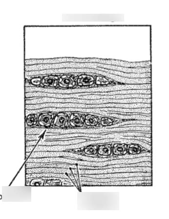 Fibrocartilage Diagram
