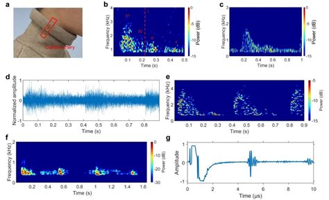 柔性超声技术前沿∣可编织且可穿戴的宽带聚合物超声换能器 上海波达医疗科技有限公司