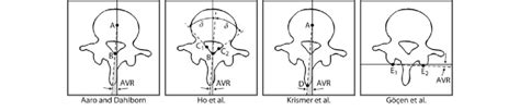 Four Manual Methods For Measuring Axial Vertebral Rotation Avr Download Scientific Diagram