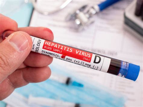 ГЕПАТИТЫН D ВИРУСИЙН ЭМИЙН ЗАРДЛЫГ УЛС ХАРИУЦНА