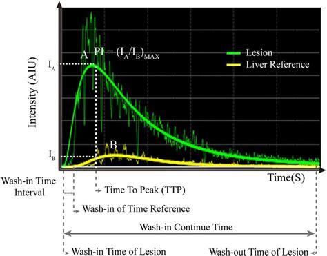Diagram Of Time Intensity Curve Download Scientific Diagram