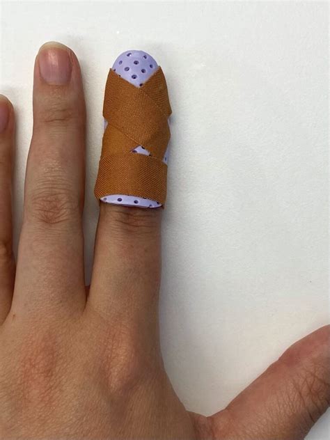 Mallet Finger Healing Process