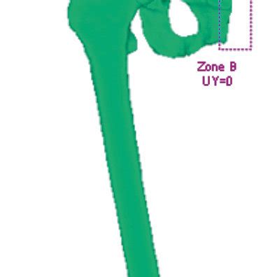 Finite Element Model Of The Right Hip Joint With Simulation Of Gluteus Download Scientific