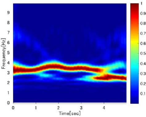 Figure 7 From A Recognition Algorithm For Electrocardiogram Based On Wavelet Transform And