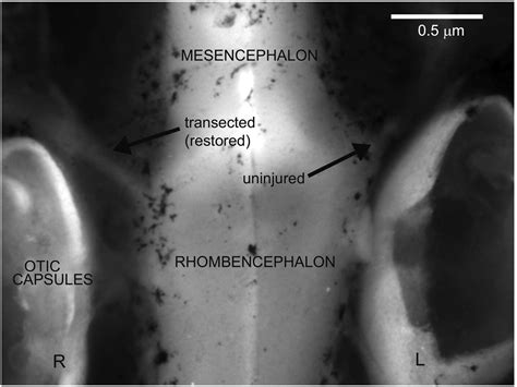 Restoration Of The Topological Organization Of The Trigeminal System