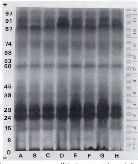 Figure 1 From Sex Difference And Gonadal Hormone Influence On Syrian