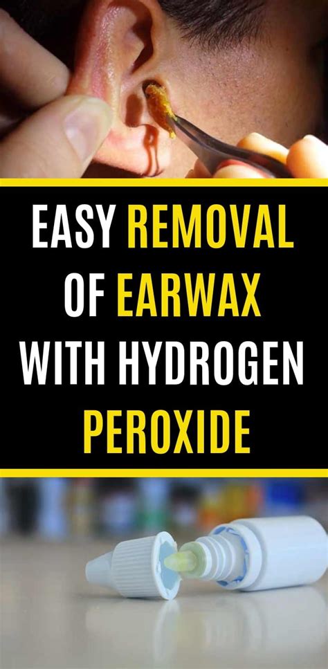 What Is The Difference Between Carbamide Peroxide And Hydrogen Peroxide For Ear Wax At Kathleen