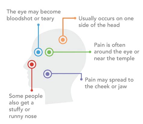 Cluster Headaches Diagram