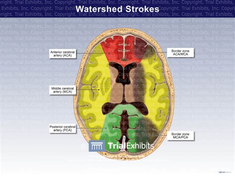 Watershed Strokes Trialquest Inc