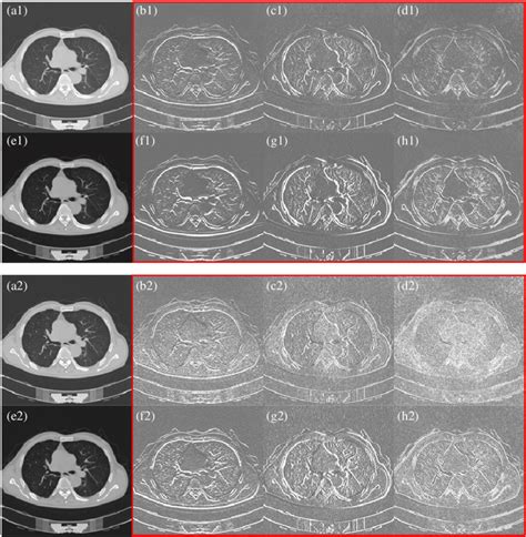 Illustration Of The 1d Directional Nonlinear Diffusions In Wavelet Download Scientific Diagram