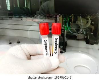 Complement Disorders Royalty Free Images Stock Photos Pictures Shutterstock