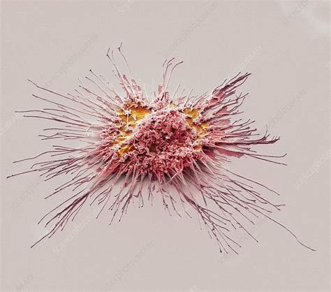 Dendritic Cell Sem Stock Image C028 8618 Science Photo Library