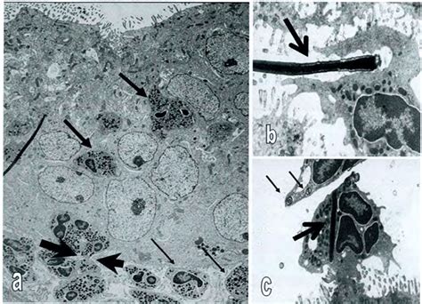 A C Entry Of Polymorphonuclear Leukocytes Pmns Into The Uterine Download Scientific Diagram
