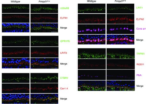 Outer Plexiform Layer OPL Synaptic Morphology Is Unaltered In Frmpd1 Download Scientific
