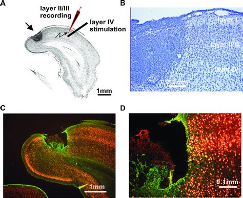 Histology Of The Laser Lesioned Rat Visual Cortex A Nissl Stained