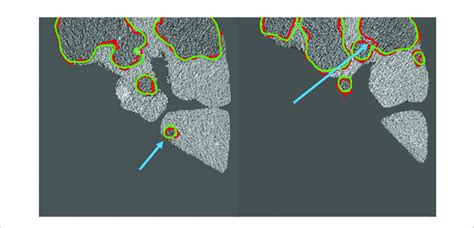 Green Contour Shows The Predicted Results By S Net Models While Red Download Scientific