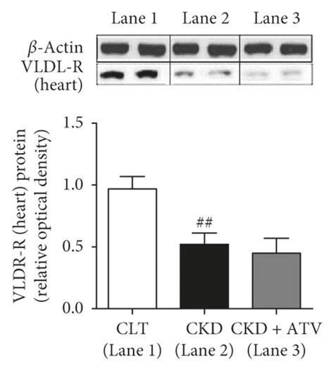 Effects Of Atorvastatin On Protein Expression Of Lipase And Vldl