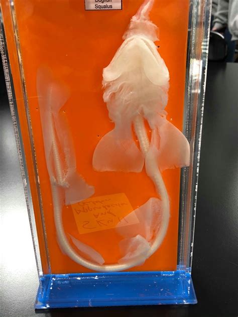 2 Appendicular Skeleton Diagram Quizlet