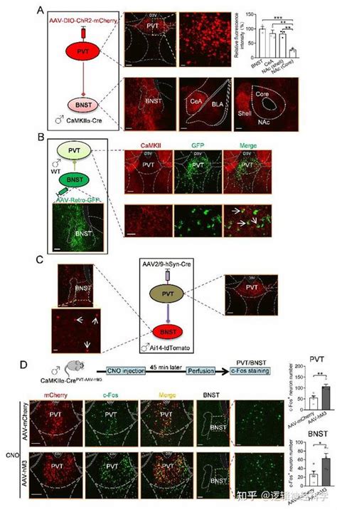 Neurobiol Dis︱李晨 李伟研究团队揭示ic→pvt→bnst神经环路调节焦虑症发病的敏感性 知乎