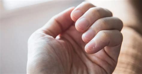 Unexpected Lung Cancer Symptom That Appears On Your Fingers Bristol Live