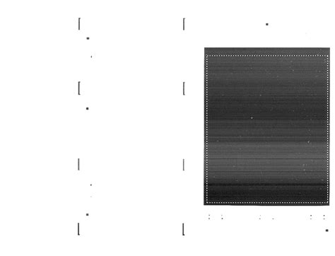 First Scans Lots Of Banding R Analogcommunity
