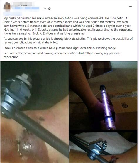 Spooky Plasma Helped My Husband Walk Independently Spooky Reviews