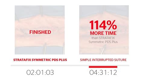 Stratafix™ Symmetric Pds™ Plus Efficiency Vs Traditional Sutures Johnson And Johnson Institute