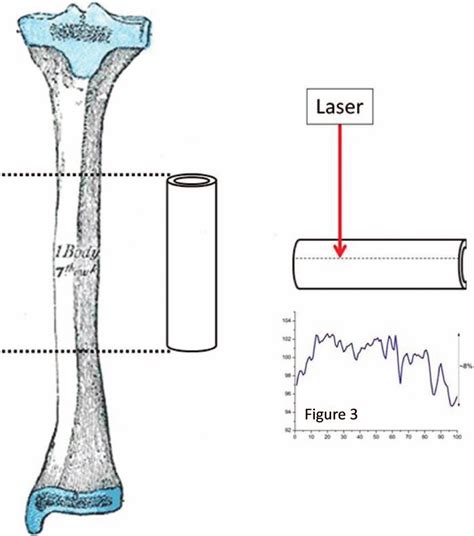 A Cm Section Approximately The Middle Of The Bone S Length Was