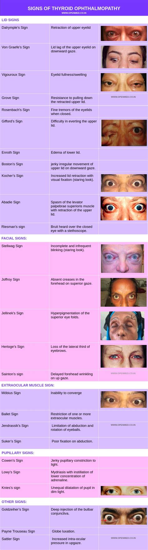 Thyroid Eye Signs