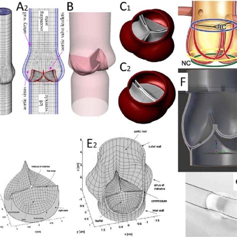 Examples Of Different Approaches To The Problem Of Aortic Valve Download Scientific Diagram