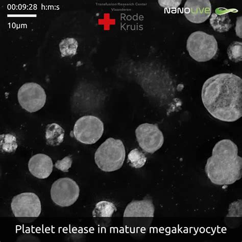 Alex Jones Phdceo On Linkedin Without Platelets We Would All Bleed