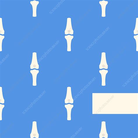 Orthopaedics Conceptual Illustration Stock Image F0414518