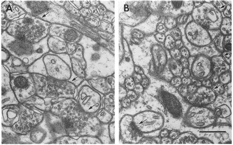 A And B Granule Cell Terminals Arrows In Cerebellum Of Wild Type